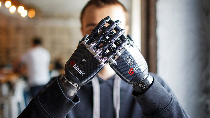 Une prothèse de bras permettant des paiements sans contact voit le jour ...